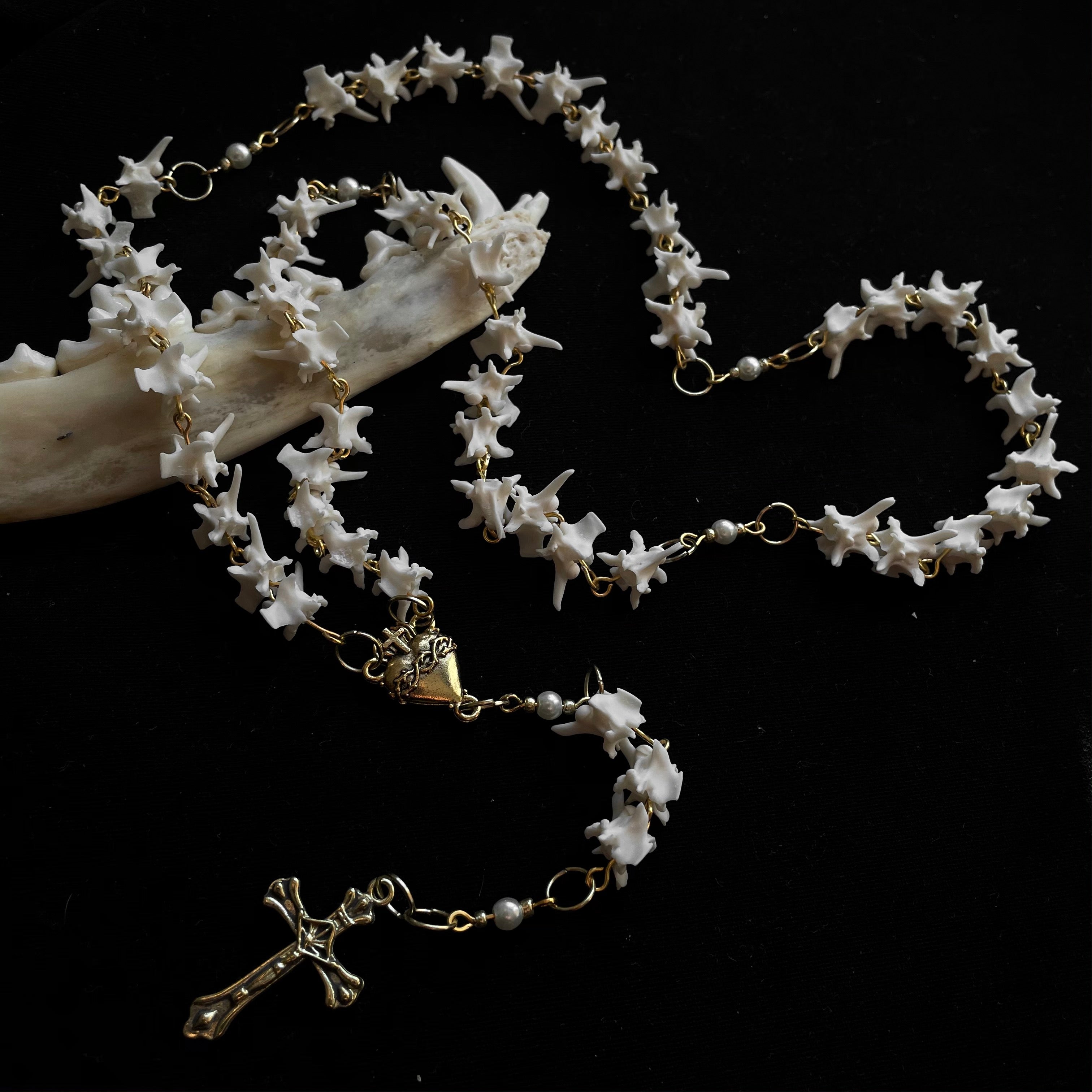 Bone Rosaries – fetalanomaly
